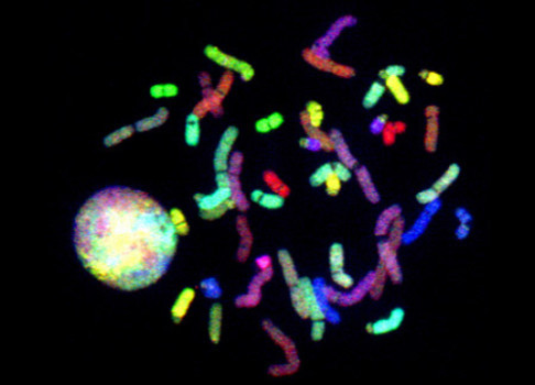 'Most Comprehensive Map' of Human Epigenomes Is Unveiled | UCSF Helen ...