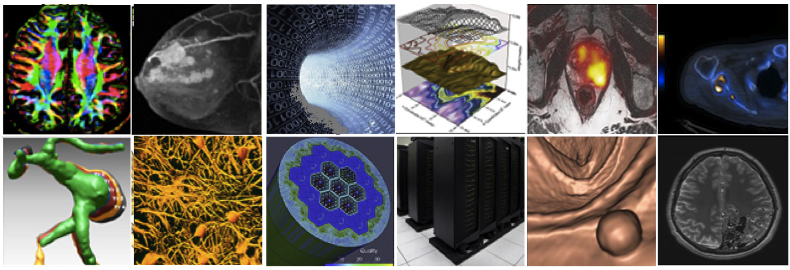 Feature: Cancer Imaging Research Core | UCSF Helen Diller Family ...