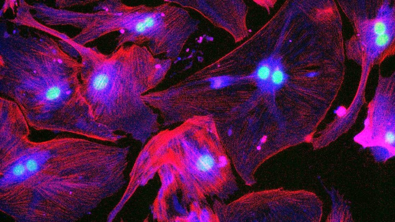 How to Thwart Cancer: Drug the Cells It Uses to Grow and Shapeshift ...